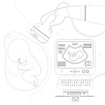 Printable Sonography Baby Coloring Page - Mimi Panda