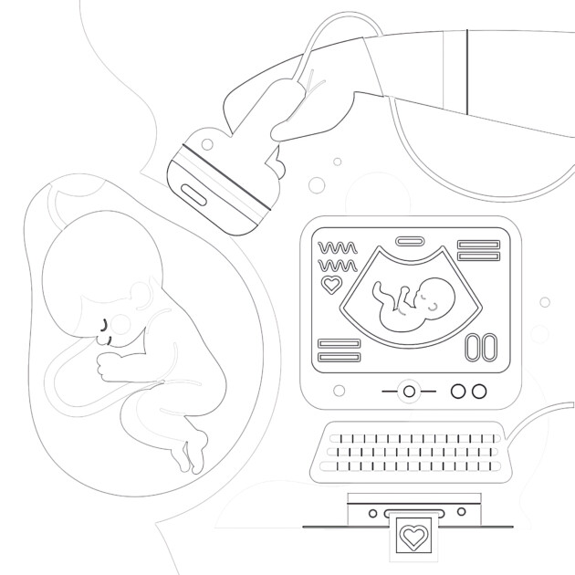 Printable Sonography Baby Coloring Page - Mimi Panda